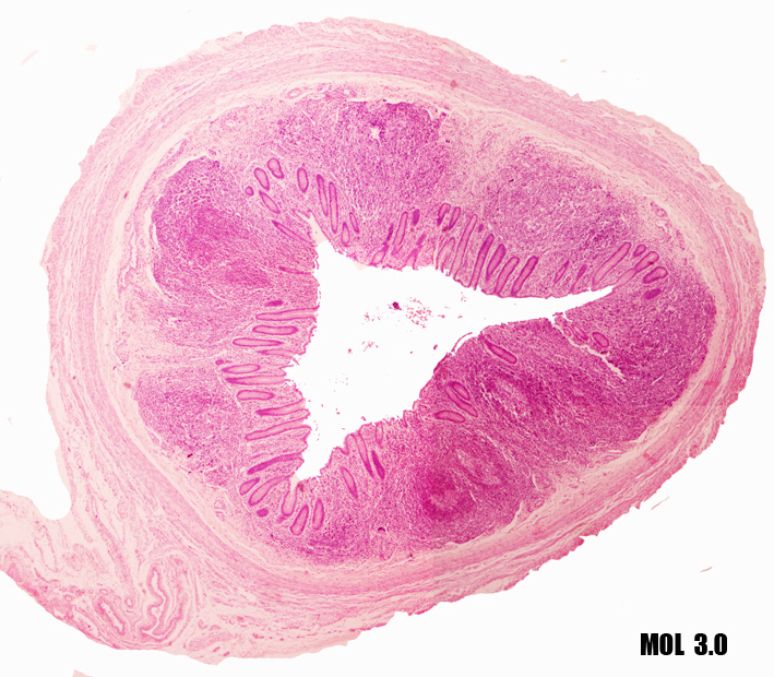 Histologia Do Apendice Vermiforme Histología En La Enfermedad