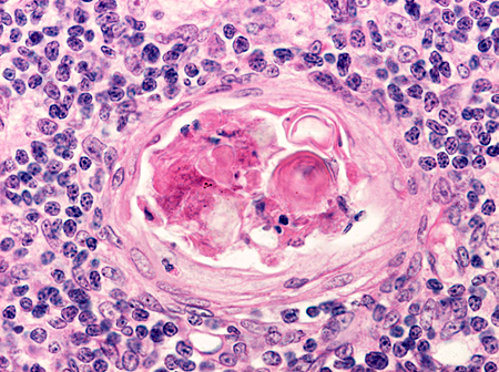 Histologia Do Timo Corpusculos De Hassall Grátis: Histologia Do Timo,