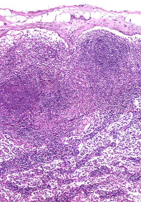 12-8 Órgãos linfoides - HISTOLOGIA