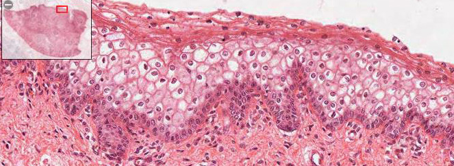 13 1 22 Mucosa Oral Histologia