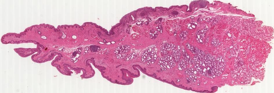 13-1-27 Mucosa oral - HISTOLOGIA