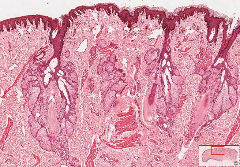 13-1-4 Mucosa oral - HISTOLOGIA