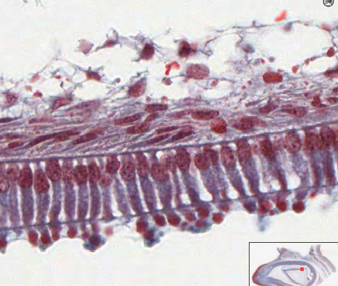 13-5-4 Amelogênese e esmalte - HISTOLOGIA