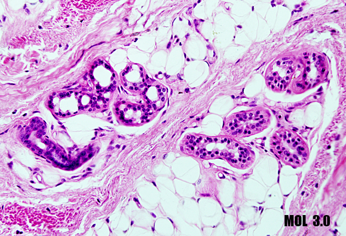 Histologia Das Glandulas Sudoriparas Ecrinas Vs Apocrinas 15 12 Pele