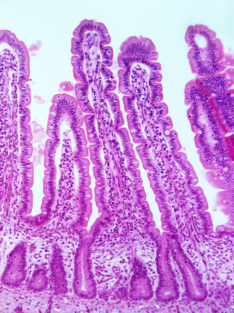 Histologia Do Jejuno Rotulada