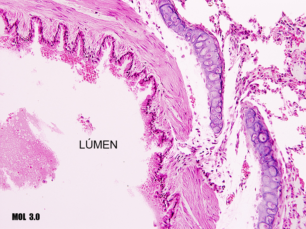 18-11 Sistema respiratório - HISTOLOGIA