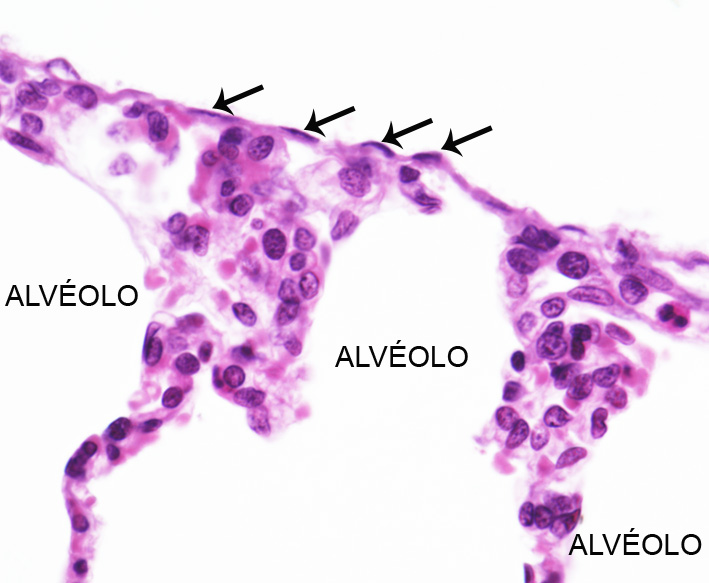 Histologia Do Tecido Pulmonar Alveolos 18 10 Sistema Respiratório