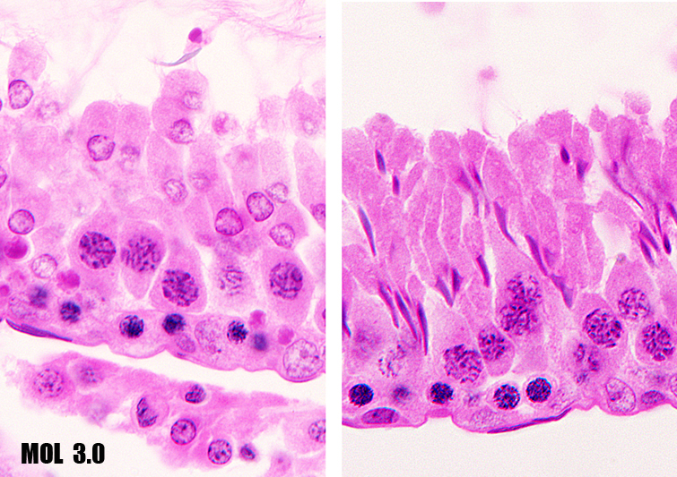 Histologia Do Testiculo Humano Histologia Sistema Reprodutor