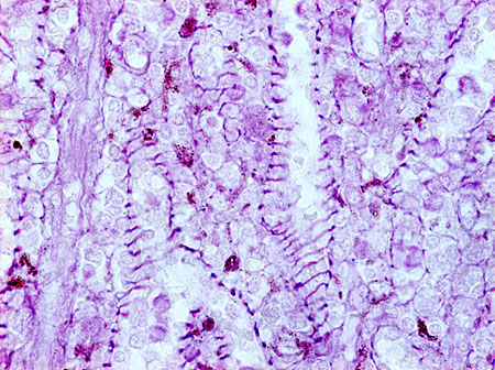 Tecido Conjuntivo Reticular Marcado Com Leucocitos