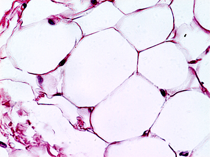5-3 Tecido adiposo - HISTOLOGIA