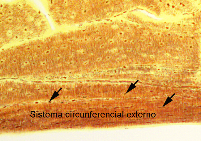 7-19 Tecido ósseo - HISTOLOGIA