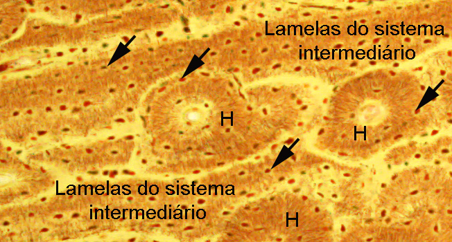 7-19 Tecido ósseo - HISTOLOGIA