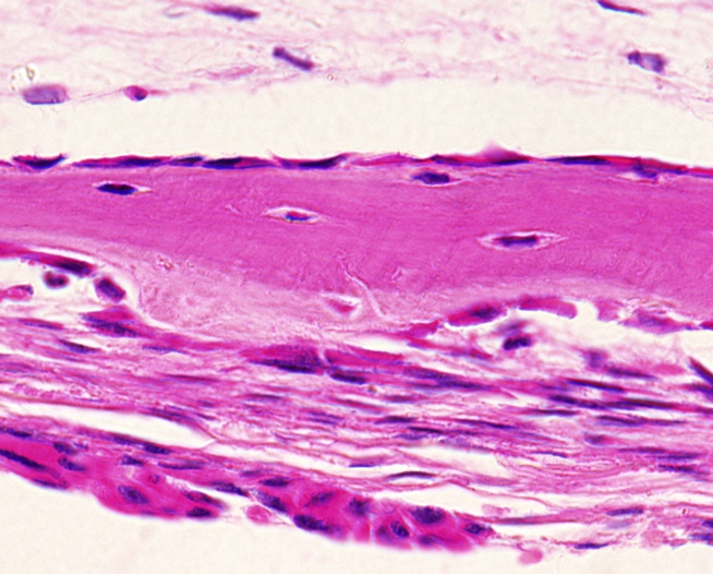 7-22 Tecido ósseo - HISTOLOGIA
